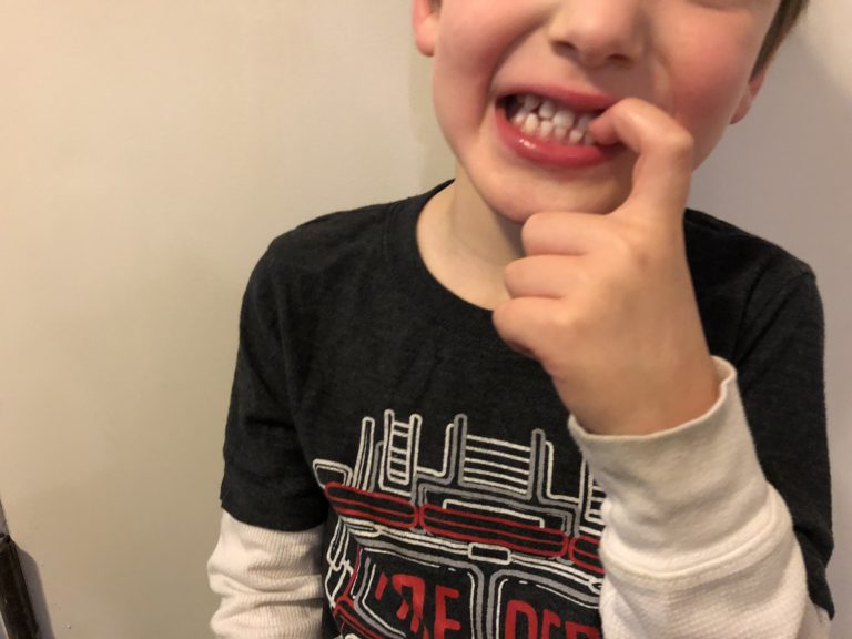 The Oral Sensory System: Why Some Kids Chew on Everything and How You ...